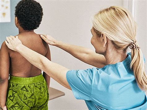 Lordosis Treatment Before After
