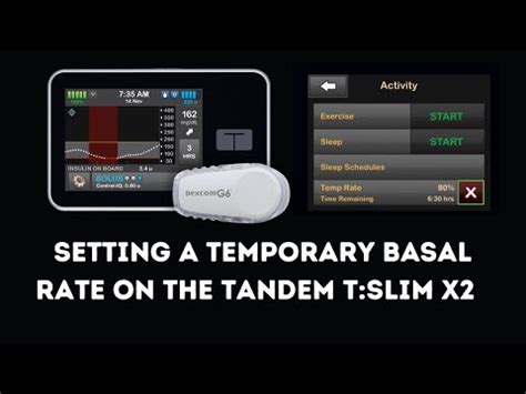 How To Set A Temporary Basal Rate On Tandem T Slim X2 Insulin Pump