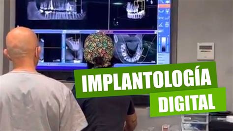 Implantología Digital Nuevo software para cirugía guiada Clínica