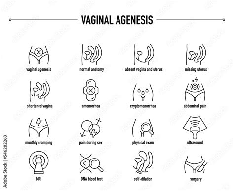 Vaginal Agenesis Symptoms Diagnostic And Treatment Vector Icon Set