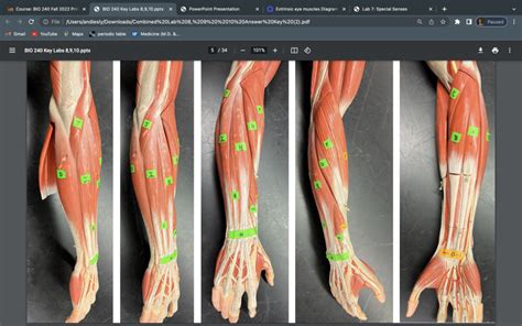 Forearm Lab Model Diagram Quizlet