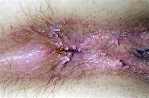 Penis In Vagina Bilder Blog Brain