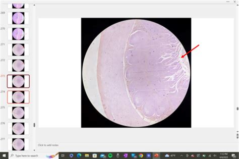 Ileum Histology Flashcards Quizlet