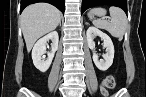11 Types Of CT Scans Deep Medical Centre