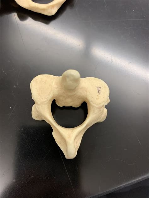 Cervical Vertebrae Axis Diagram Quizlet
