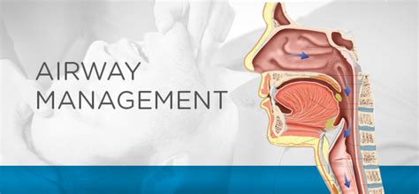 Airway Management Otwo