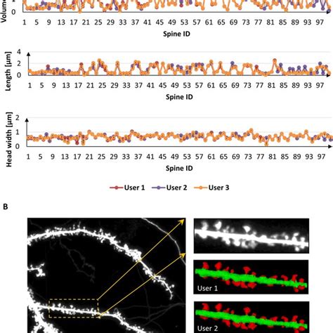 segmentation of dendritic spines from complex dendritic tree in brain download scientific