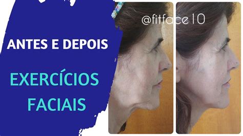 GINÁSTICA FACIAL ANTES E DEPOIS Como tirar fotos perfeitas YouTube