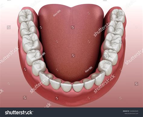 Difference Between Maxillary And Mandibular Molars Off