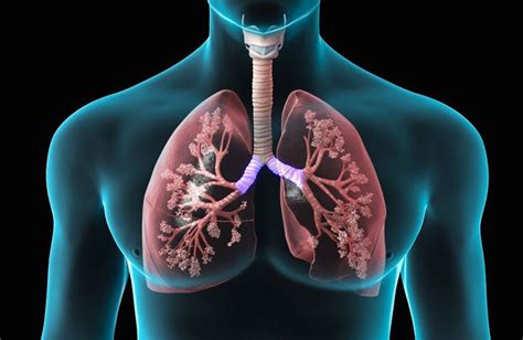 Casos de Síndrome Respiratória Aguda Grave aumentam 135 no Brasil