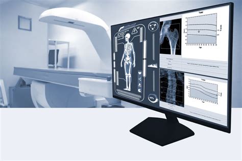 Detectar Y Prevenir La Osteoporosis Con Densitometr A Sea Resobert