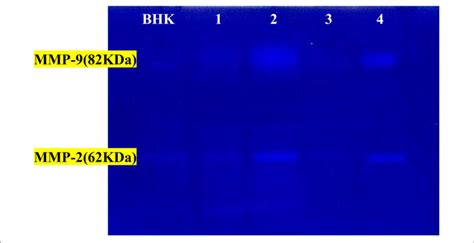 The Activity Of Mmp And Mmp By Gelatin Zymography Lanes