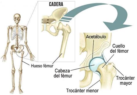Fractura De Cadera Del Anciano Qu Es Causas S Ntomas Tratamiento Y