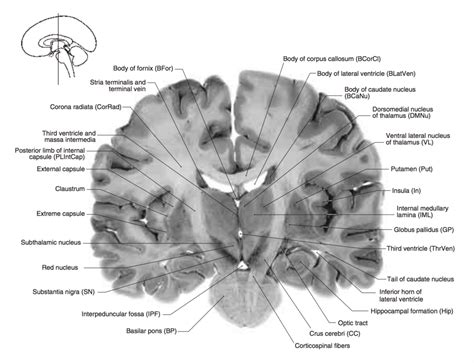 Lab 2 Coronal Sections Part V Diagram Quizlet