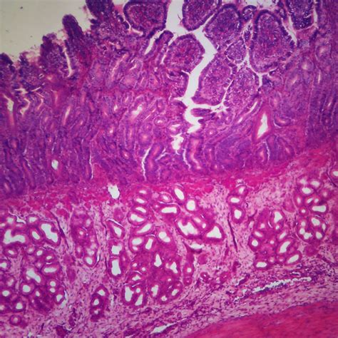 Mammal Duodenum sec 7 µm H E Microscope Slide Carolina