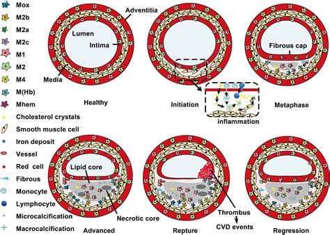Frontiers Macrophage Plasticity And Atherosclerosis Therapy