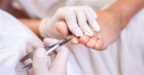 Descubrir 92 imagen como cortar correctamente las uñas de los pies