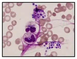 Wright S Stain Procedure Principle Components Uses And Blood Smear