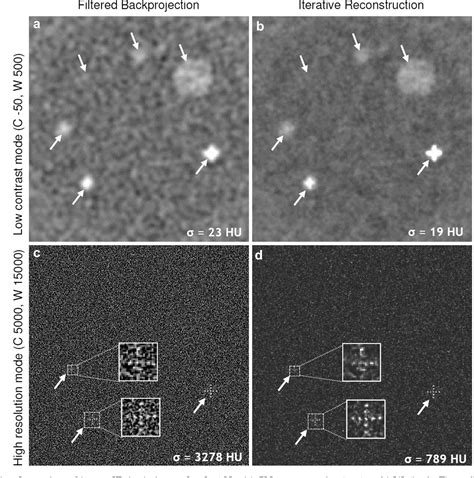 [pdf] iterative reconstruction methods in x ray ct semantic scholar