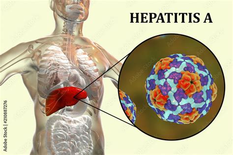 Hepatitis A Viruses Hav In Liver D Illustration Hav Infect Humans