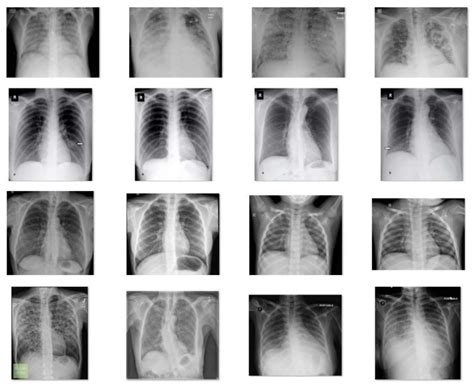 healthcare free full text an automated glowworm swarm optimization with an inception based