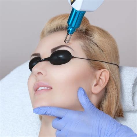 Laser Q Switch para Manchas e Melasma Inove Estética Avançada