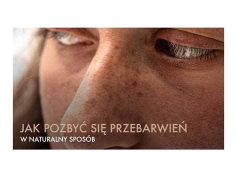 Jak pozbyć się przebarwień skóry w naturalny sposób