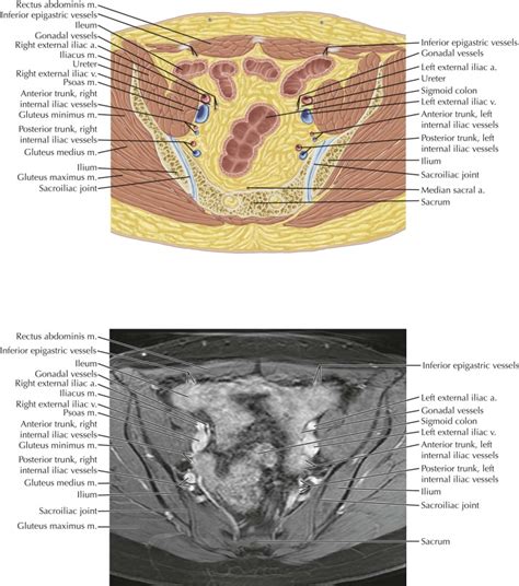 Female Pelvis Radiology Key