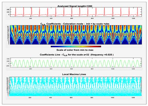 bioengineering free full text a hybrid deep learning approach for ecg based arrhythmia