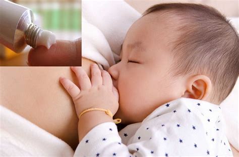 Acyclovir có an toàn cho phụ nữ có thai và cho con bú
