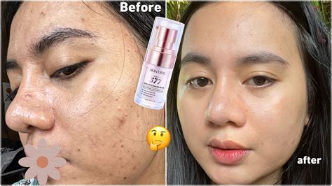 4 Rekomendasi Serum Untuk Kulit Kering Dan Flek Hitam Bikin Wajah