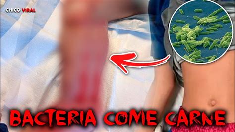 La BACTERIA COME CARNE Que PUEDES CONTRAER En La PLAYA YouTube