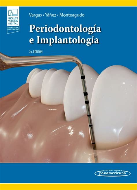 Amazon Periodontología e Implantología e book 9786078546589