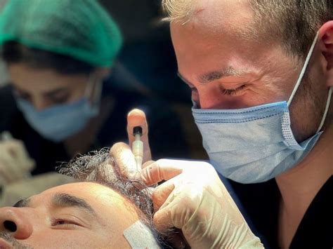 Przeszczep Włosów Metodą DHI w Turcji Procedura i Cena Heva Clinic