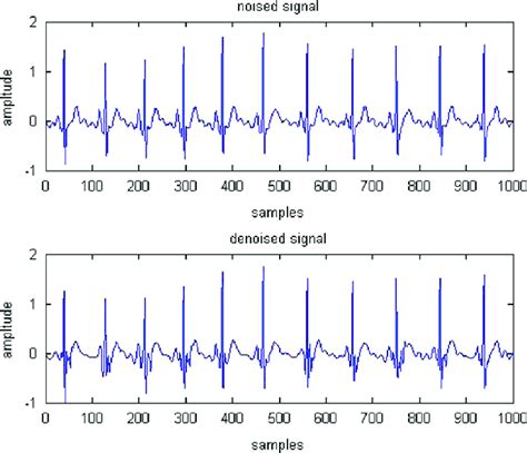 de noising of ecg signal download scientific diagram