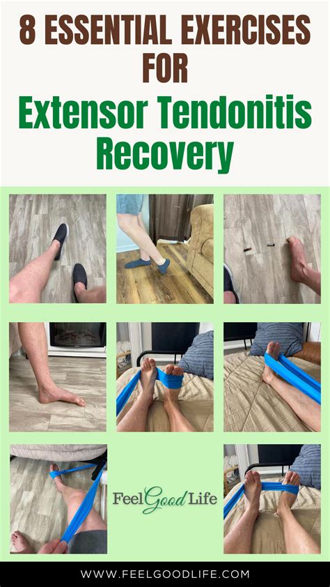 Extensor Tendonitis Causes Symptoms Treatment Artofit
