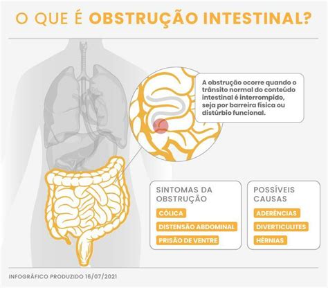 Obstrução intestinal saiba tudo sobre a condição que acometeu Jair