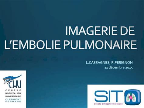 PDF IMAGERIE DE LEMBOLIE PULMONAIRE MARIE PIERRE REVEL Hôpital