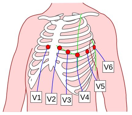 Lead Ecg Circuit Diagram