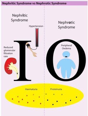 Difference Between Nephrotic And Nephritic Syndrome Medizzy