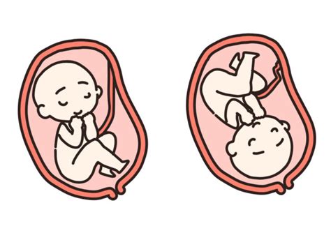 Vị trí thai nhi trong bụng mẹ 3 tháng giữa thế nào mới là an toàn