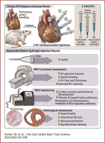 Myocardial Matrix Hydrogels Mitigate Negative Remodeling And Improve