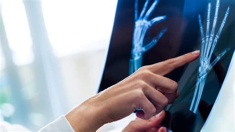 Rheumatoid Arthritis RA Tests Diagnosing Testing For RA