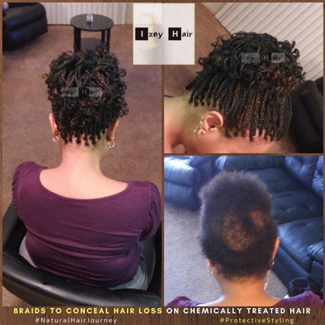 Braids For Alopecia