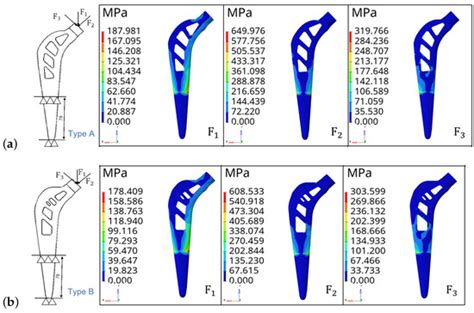 multi scale topology optimization of femoral stem structure subject to stress shielding reduce