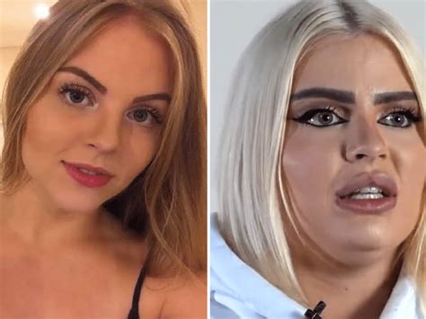 Mistério revelado o que está por traz do antes e depois de Luísa Sonza