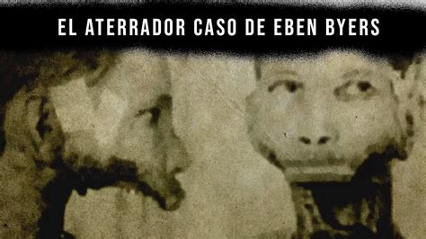 El aterrador caso de Eben Byers El hombre sin mandíbula YouTube
