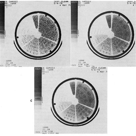 pdf noise and contrast discrimination in computed tomography