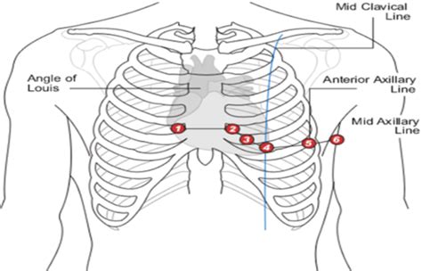 Diagnostics Iii Ekg Basics Flashcards Quizlet