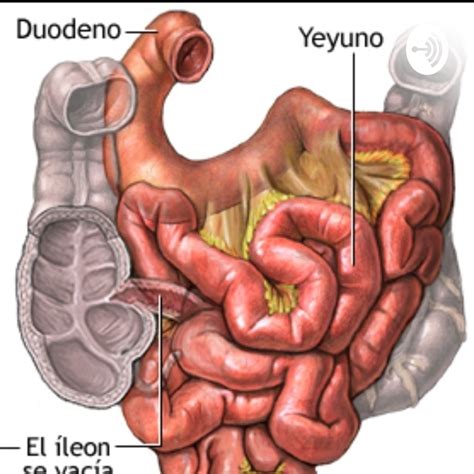 Intestino Delgado Generalidades y Patologías Podcasts en Español